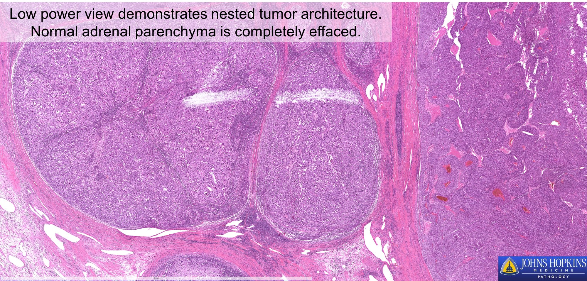 Adrenal Histology
