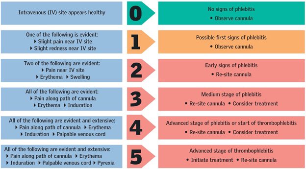 Infiltration Vs Phlebitis