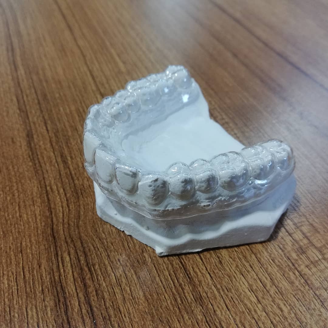 Digident Dental Protez Lab (@digident_dental) | Twitter