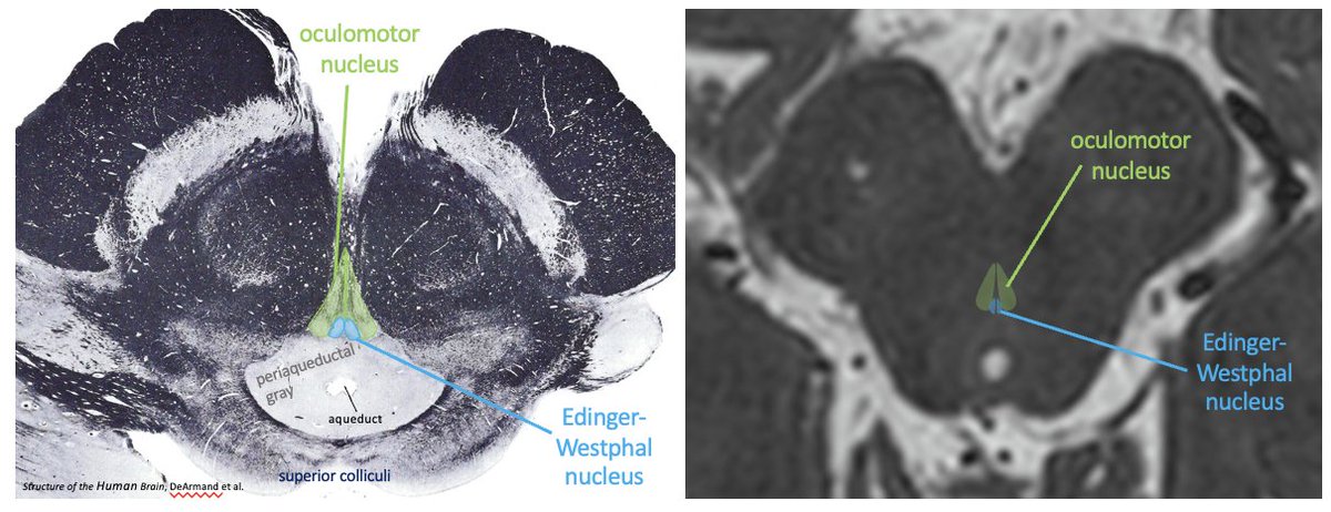 A reminder to all #radres on their first #neurorad rotation: in the # ...