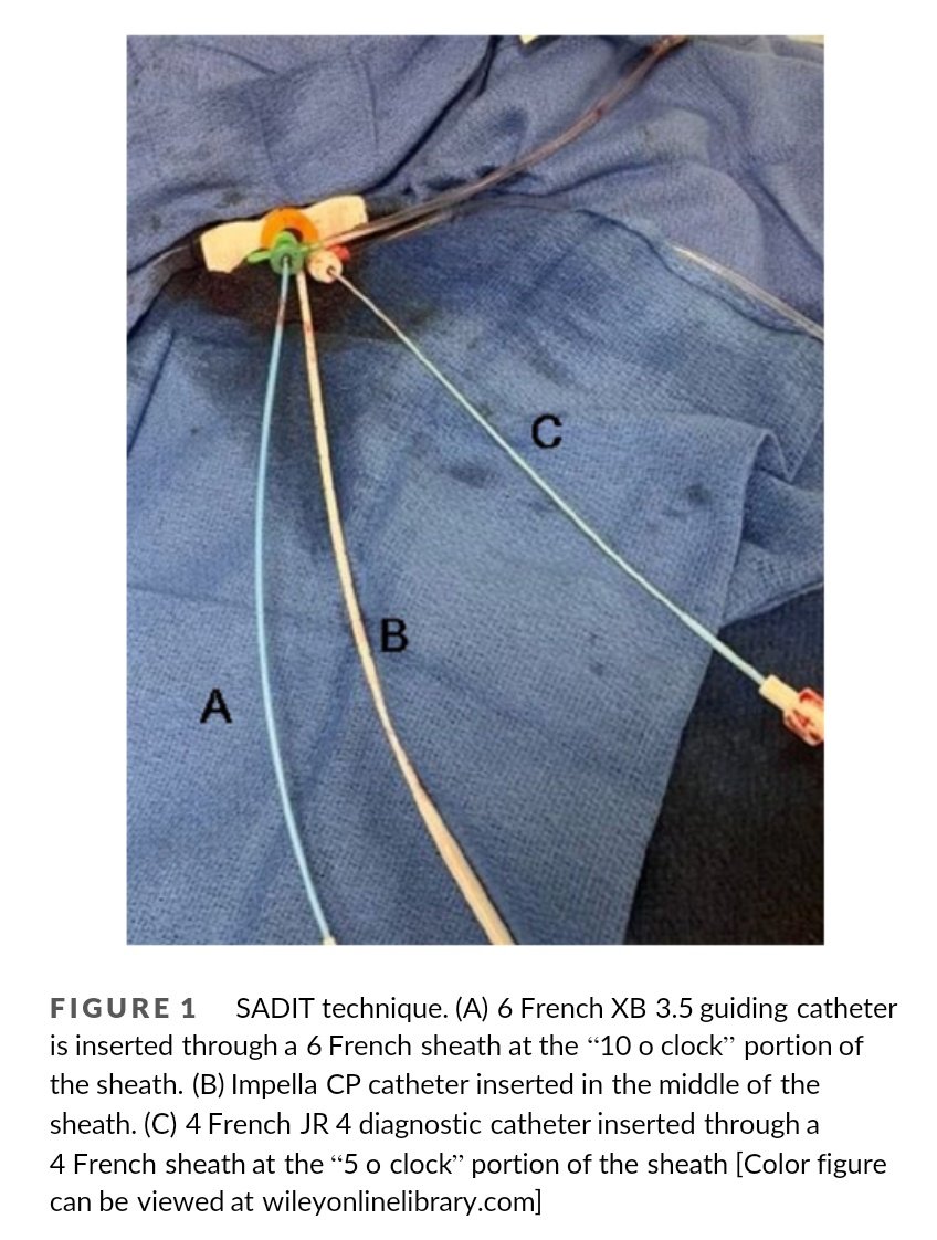 Jr Catheter Authorized Site | brunofuga.adv.br