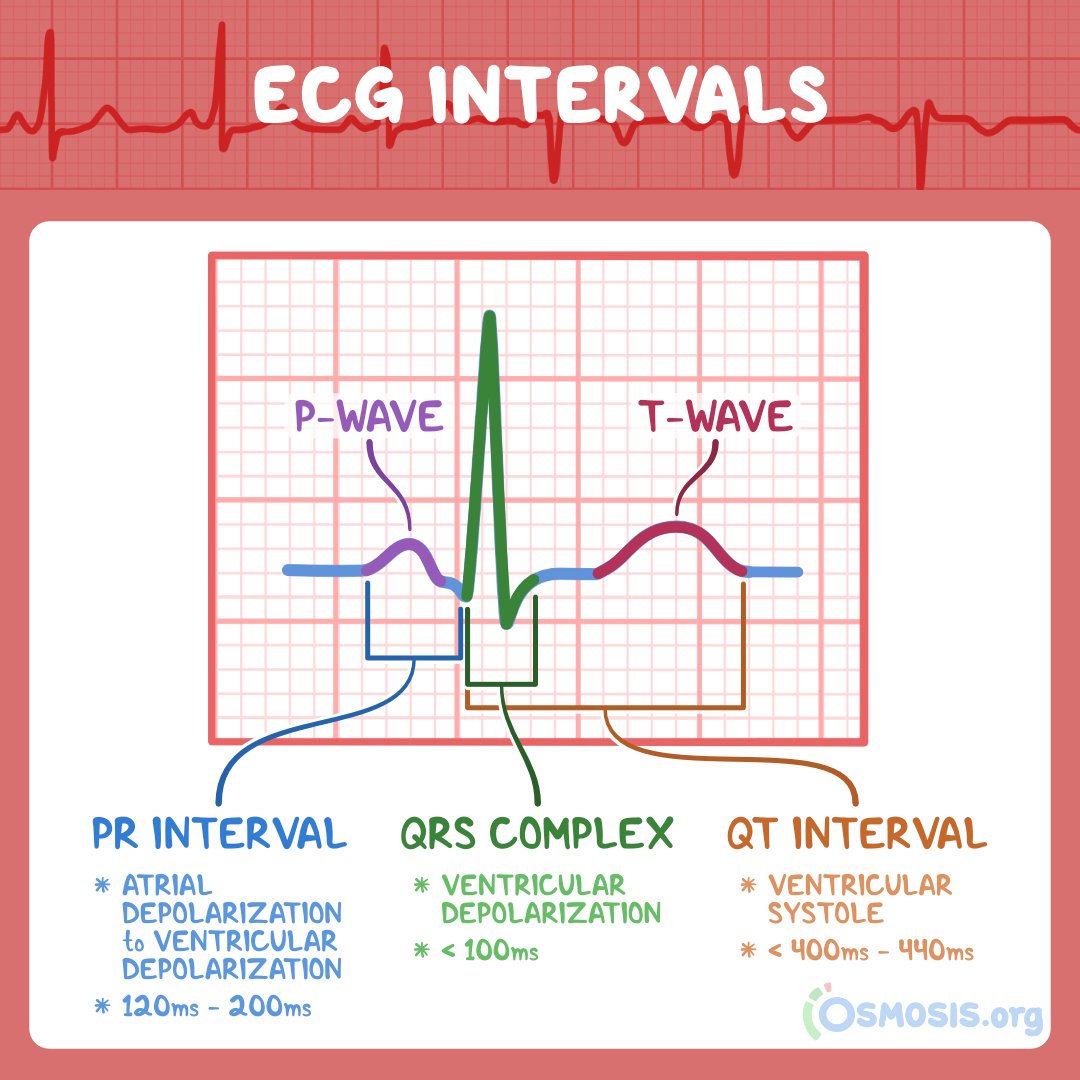 Ecg Normal Sinus Rhythm Osmosis - vrogue.co