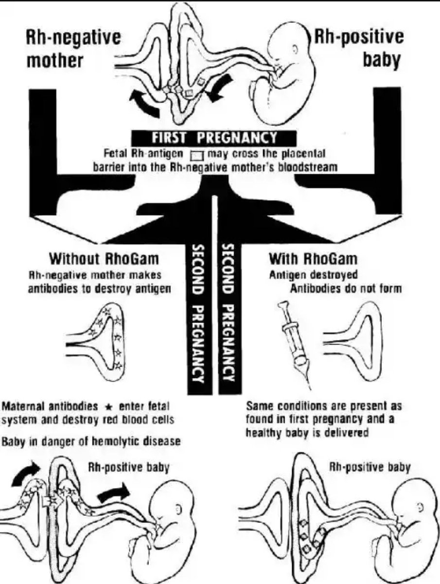Rh Negative Blood Type Pregnancy