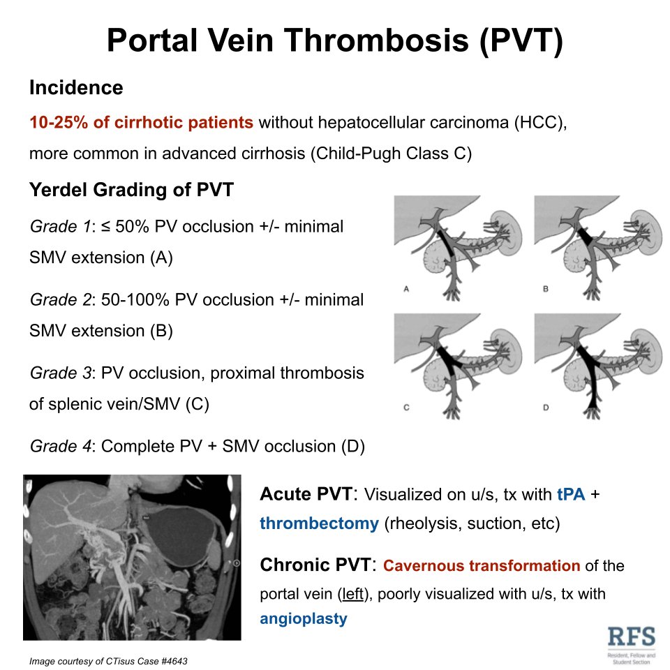 Portal Vein Obstruction