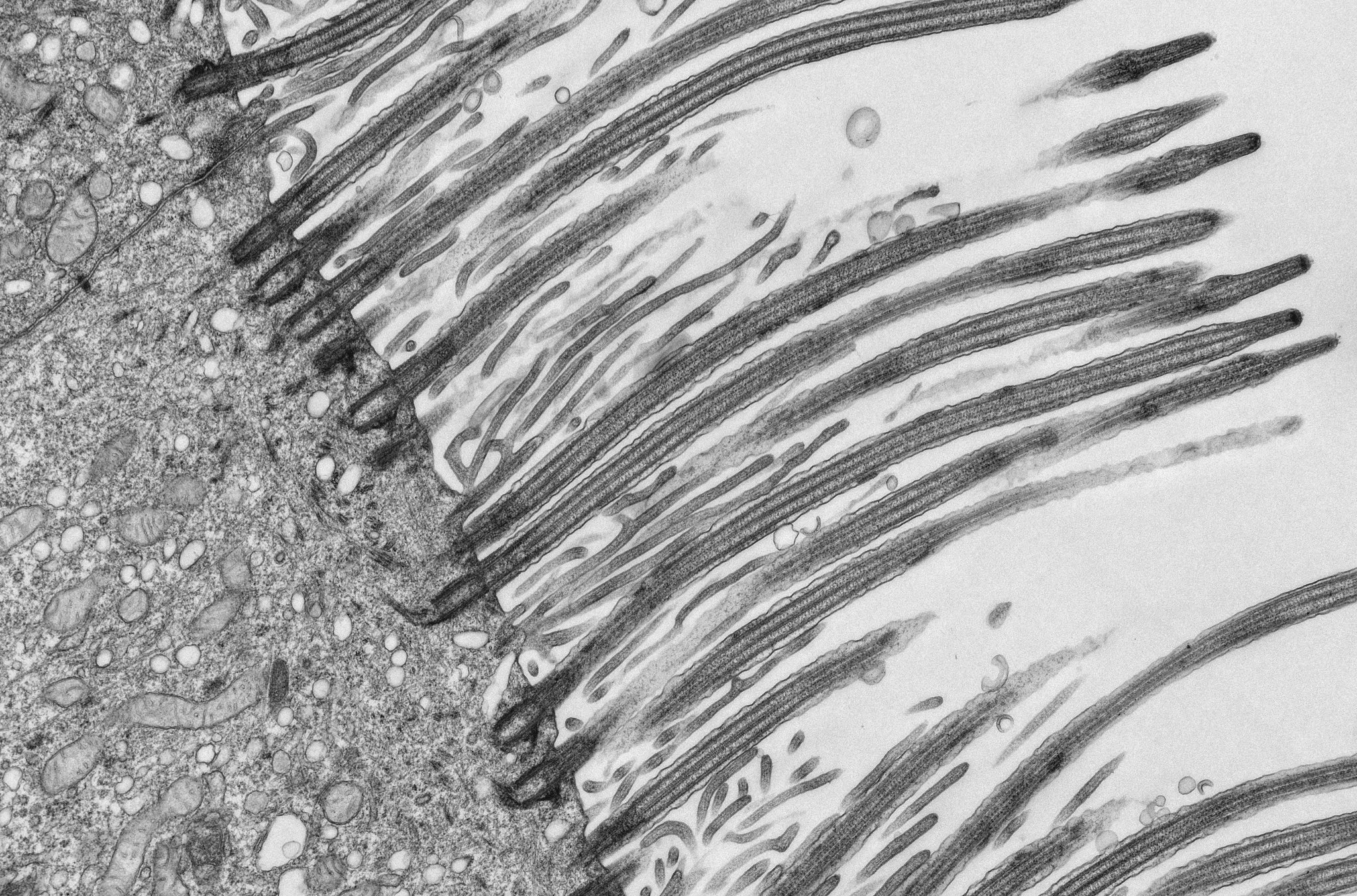 Cilia Electron Microscopes