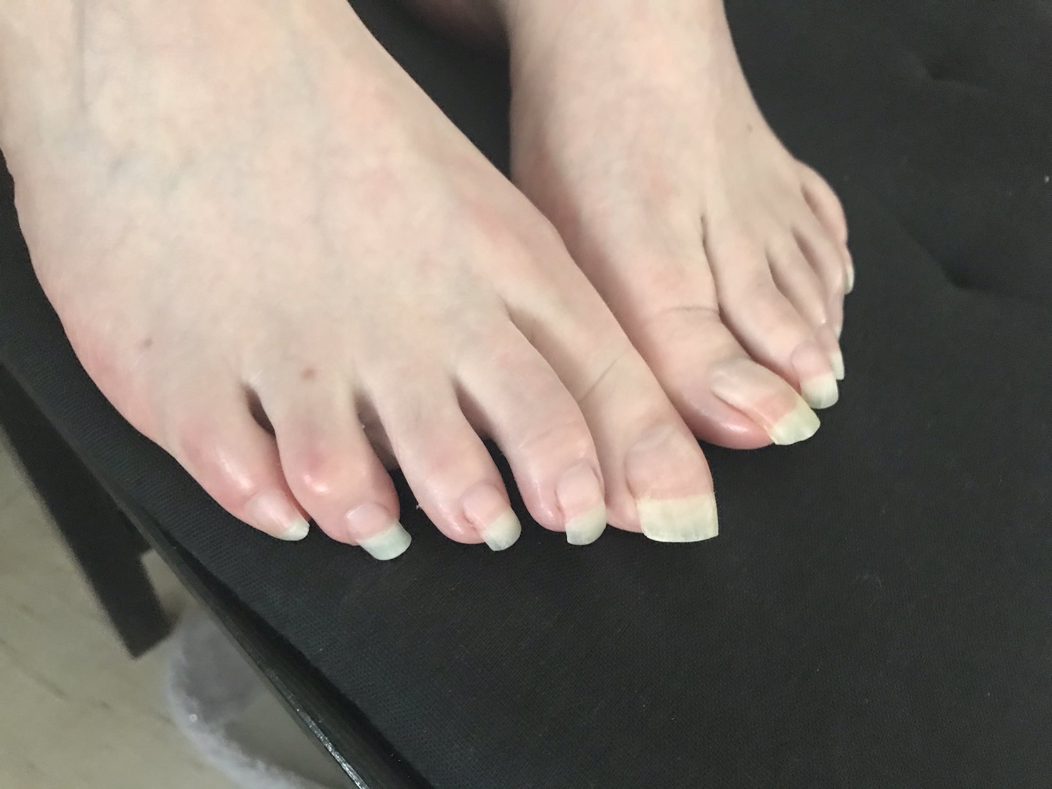 Natural Toenails