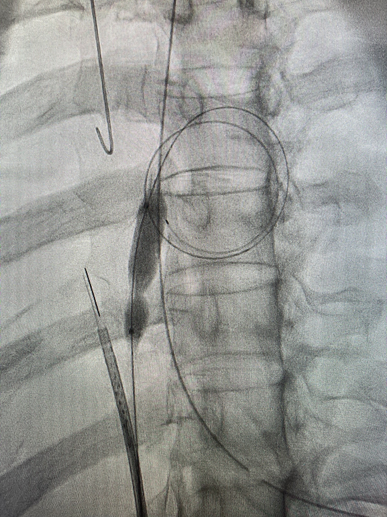 Baylor Med Adv Heart Failure & Structural Heart (@BCMAdvStrlHeart) / Twitter