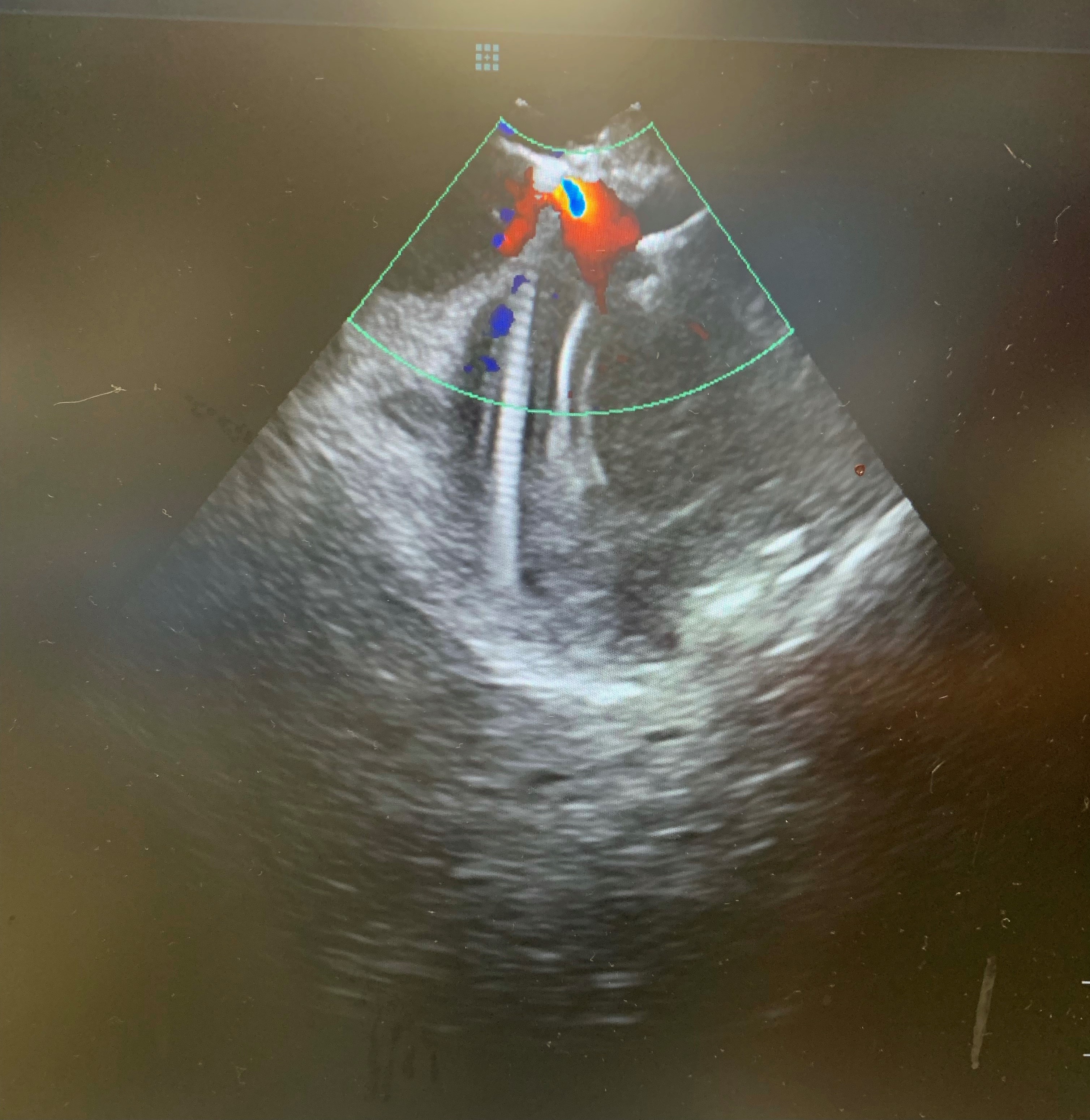 Baylor Med Adv Heart Failure & Structural Heart (@BCMAdvStrlHeart) / Twitter