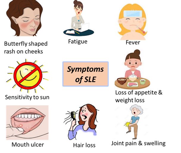 هالثريد بيتكلم عن | SLE Systemic lupus erythrematosus - Thread from MLT ...