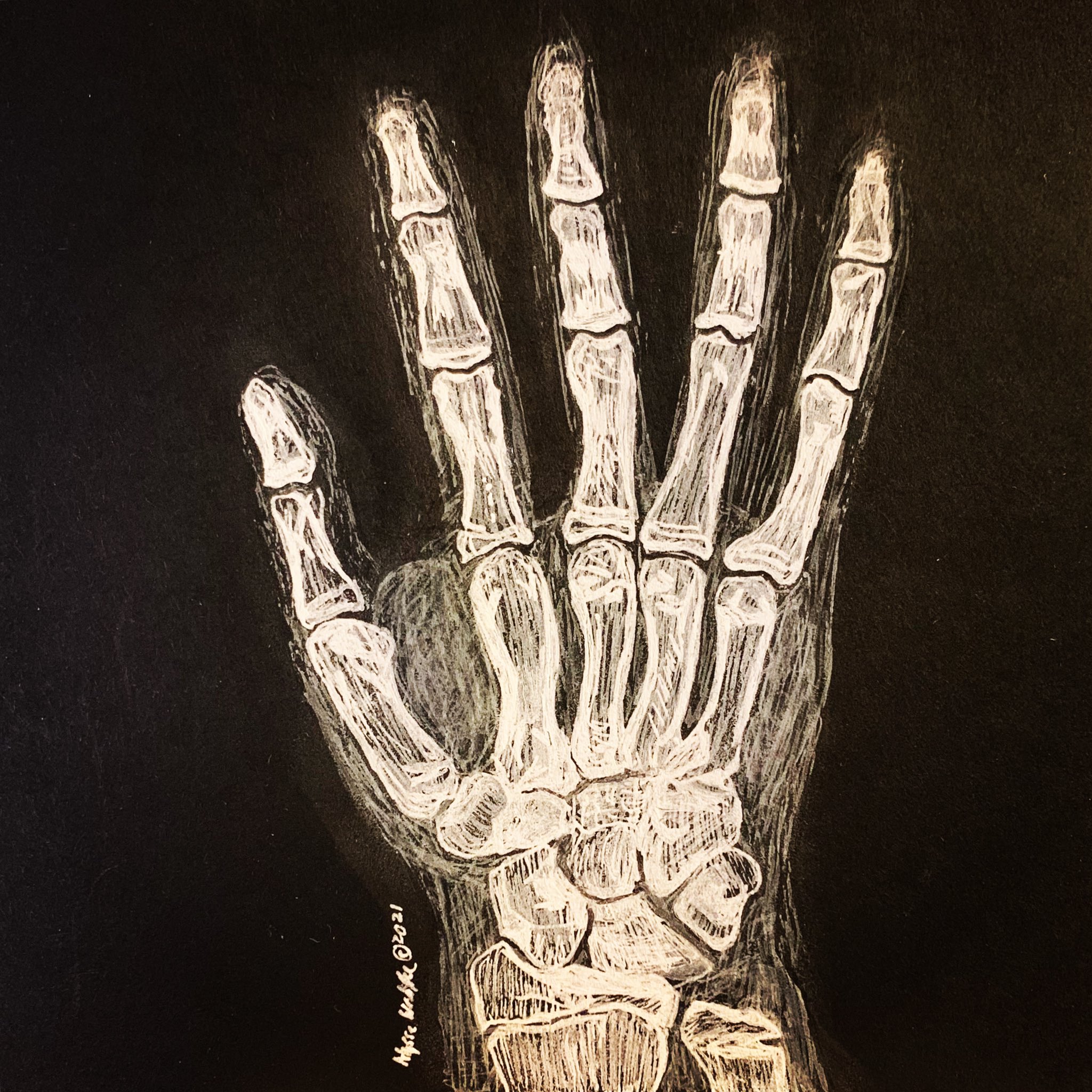 X Ray Hand Drawing X Ray Hand Arm Stock Vector Images Alamy