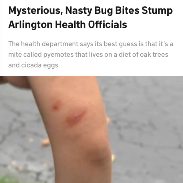 Nasty Spider Bites