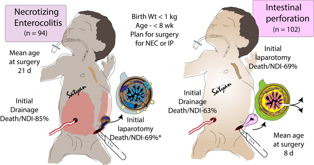 Intraperitoneal Drain