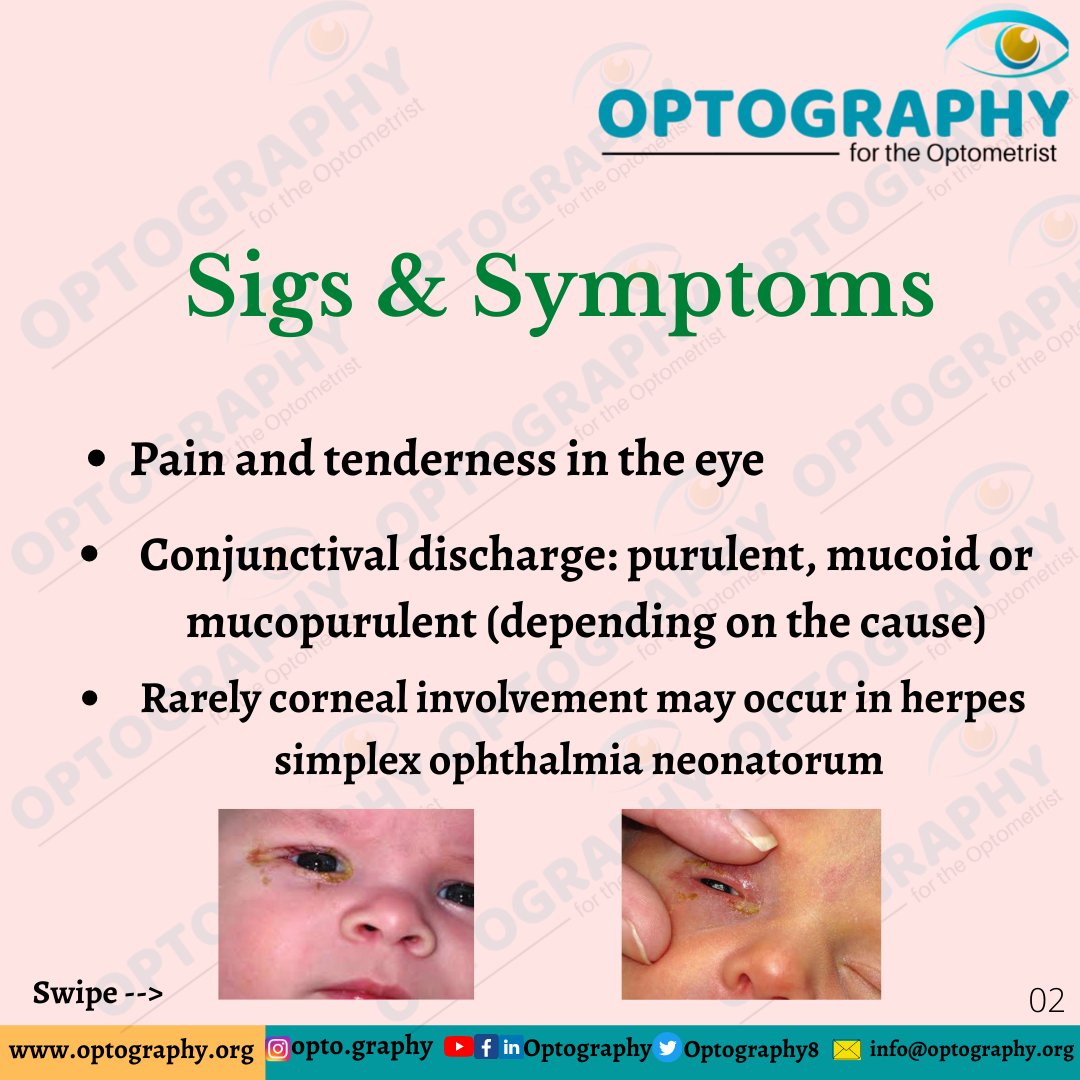 Ophthalmia Neonatorum