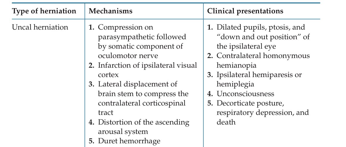 Uncal Herniation Eye