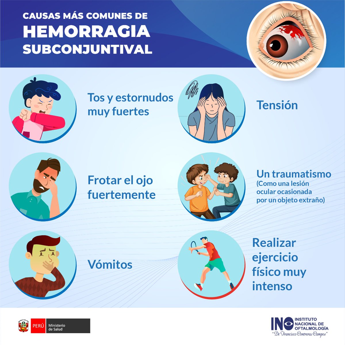Image Hemorragia Subconjuntival Manual Merck Versin