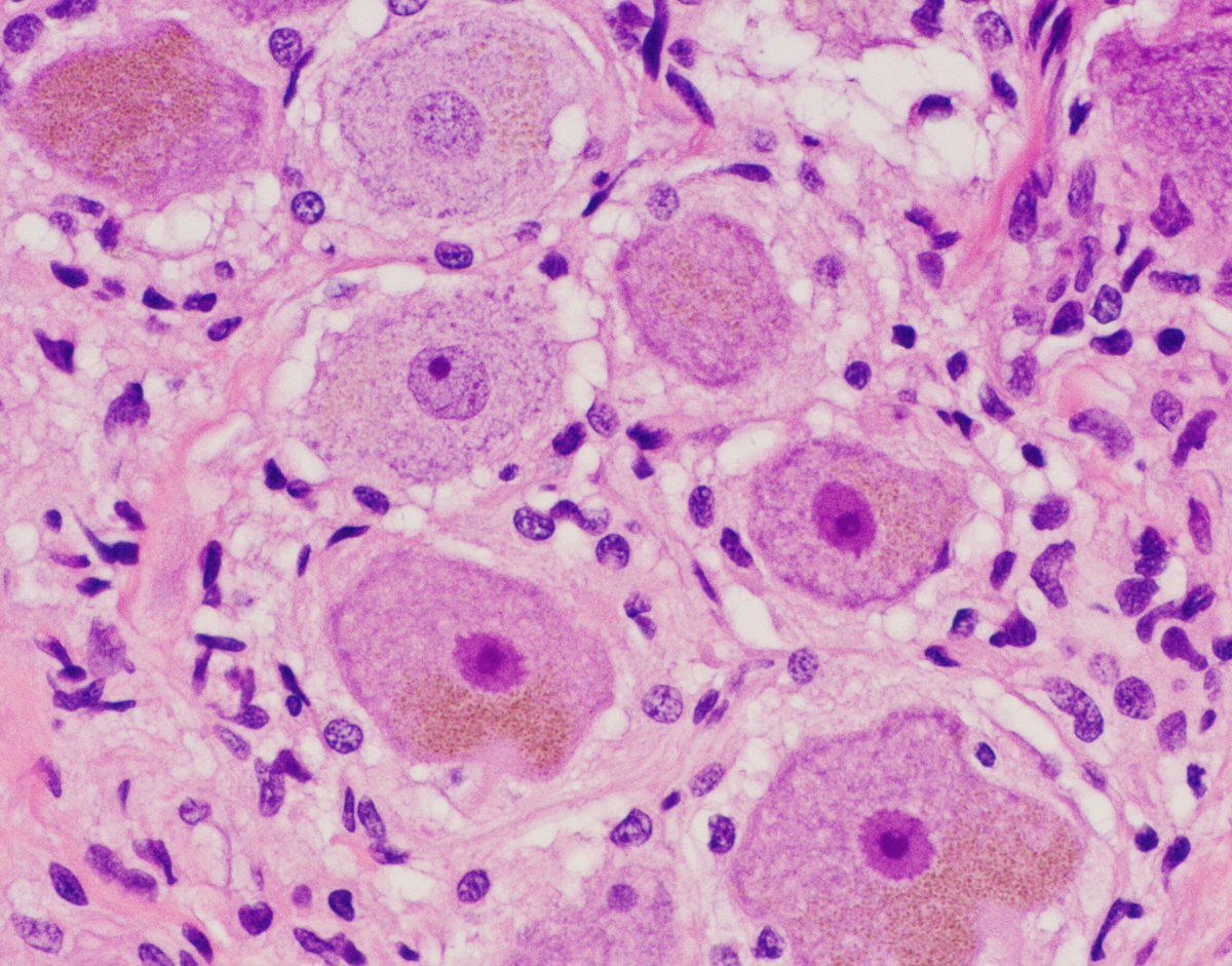 Dorsal Root Ganglion Histology