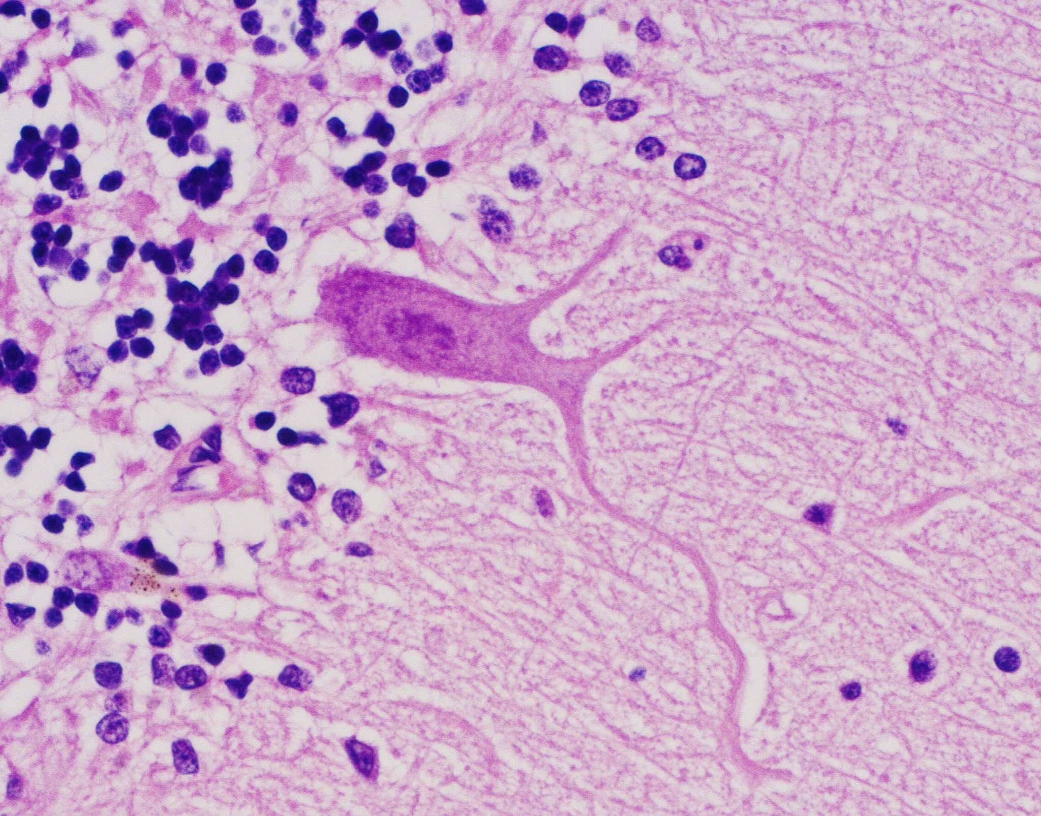 Purkinje Cells Histology