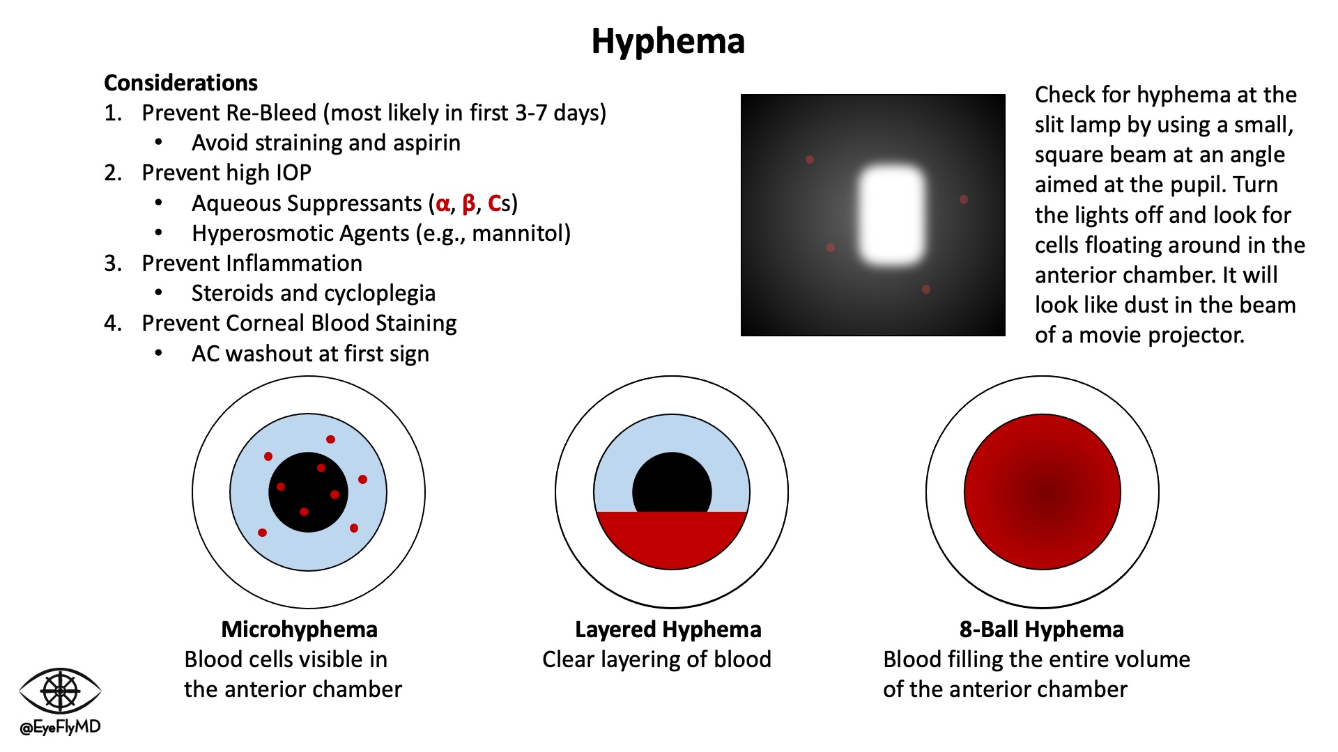 Hyphema