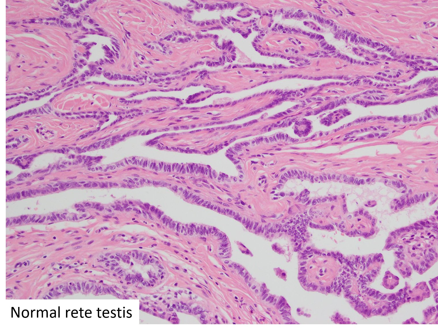 Rete Testis Diagram