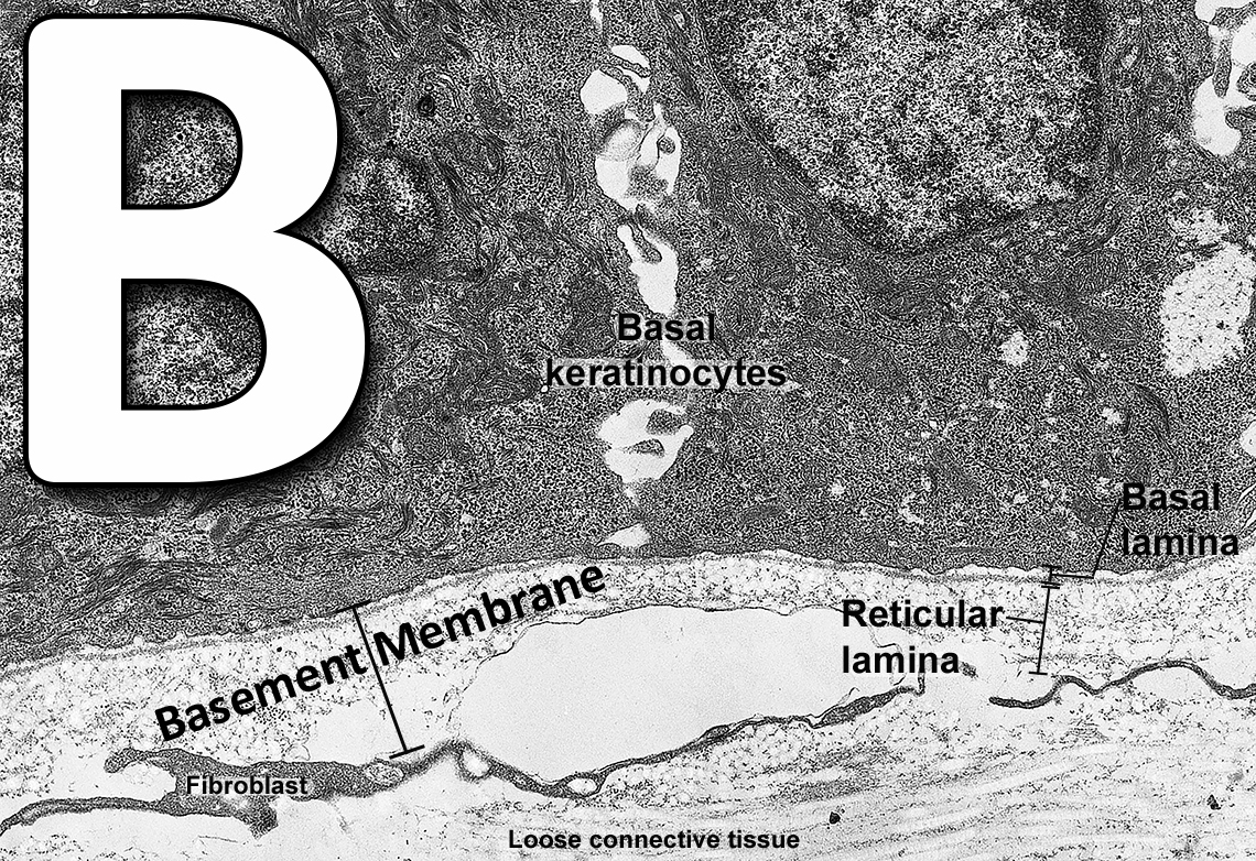 Basal Lamina Histology