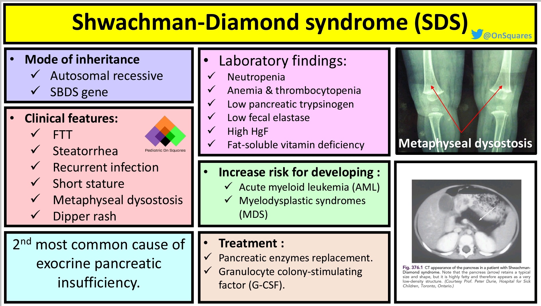 Shwachman Diamond Syndrome