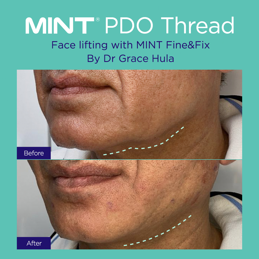 Mint pdo threads - droreading