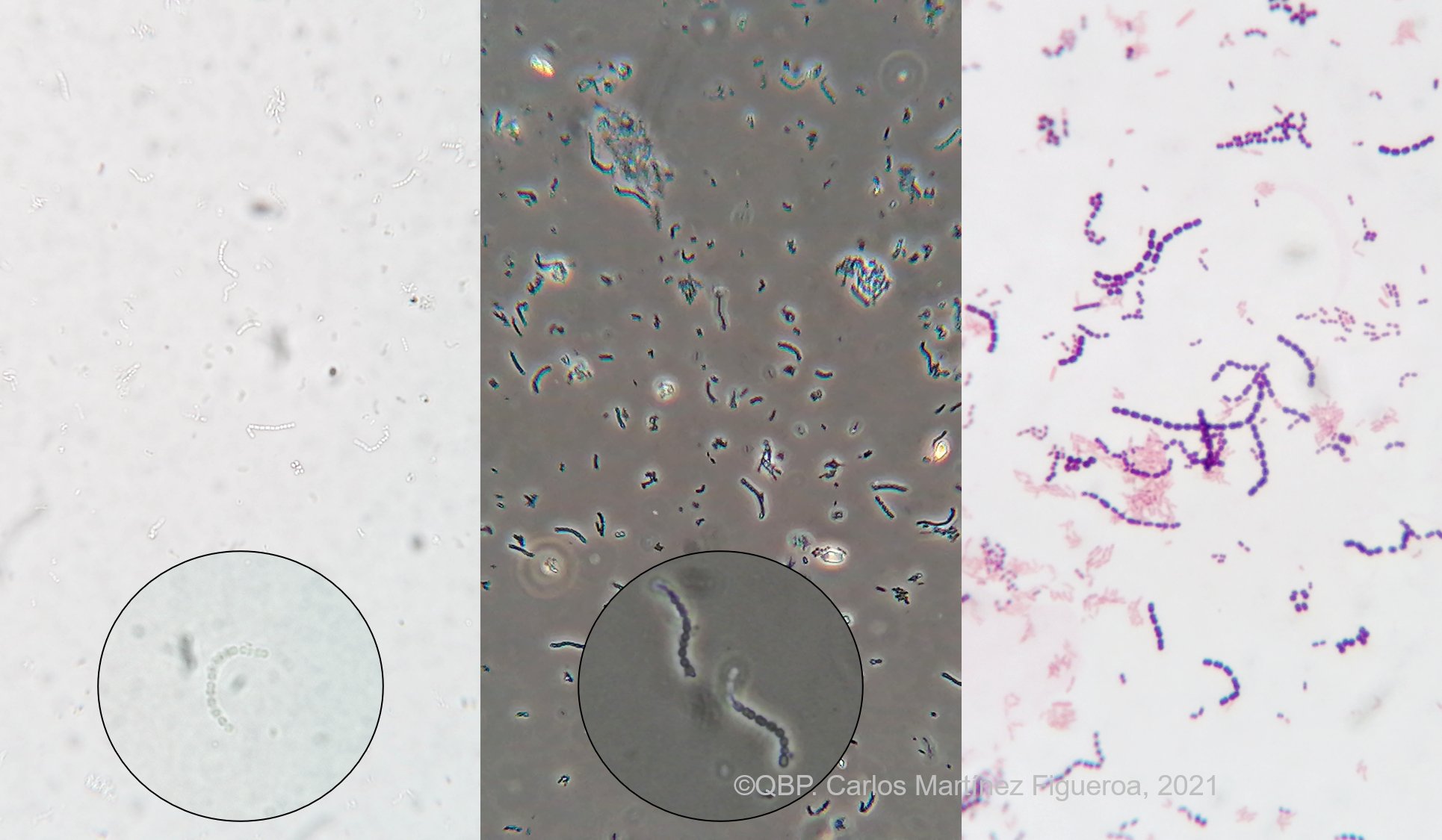 Cocci Bacteria In Urine