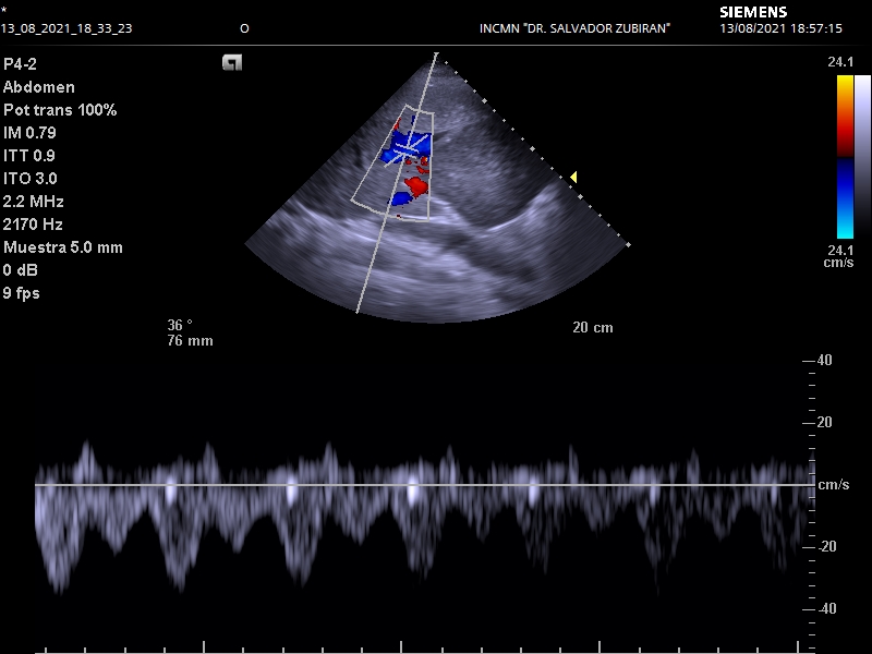 #AKIConsultSeries 👵 w renal cell carcinoma and suspected heart failure ...
