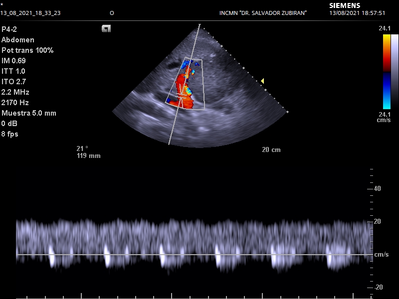 #AKIConsultSeries 👵 w renal cell carcinoma and suspected heart failure ...