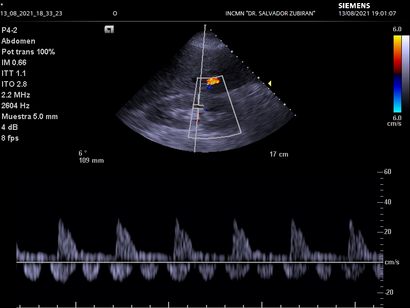 #AKIConsultSeries 👵 w renal cell carcinoma and suspected heart failure ...