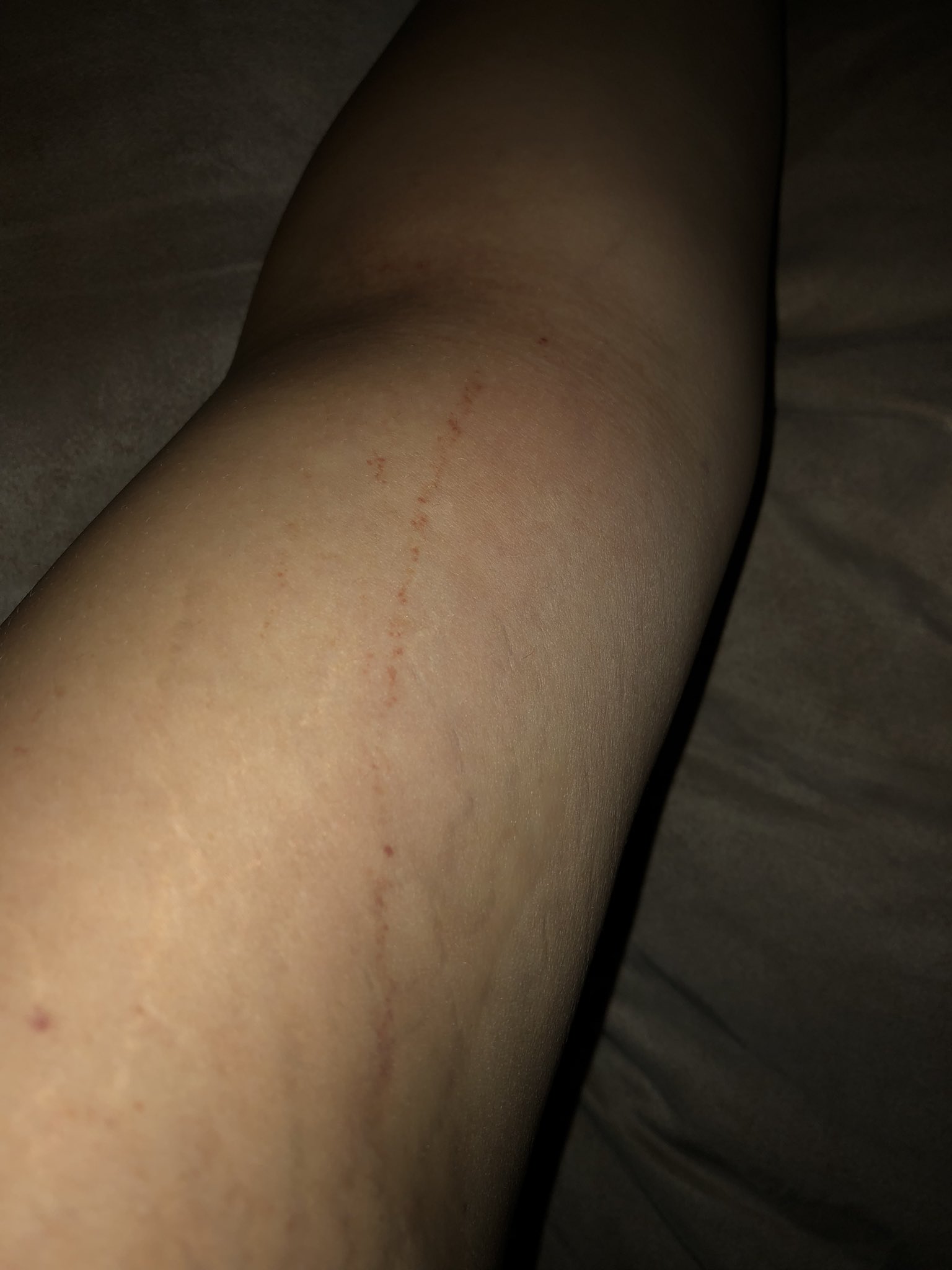 Cut On Arm
