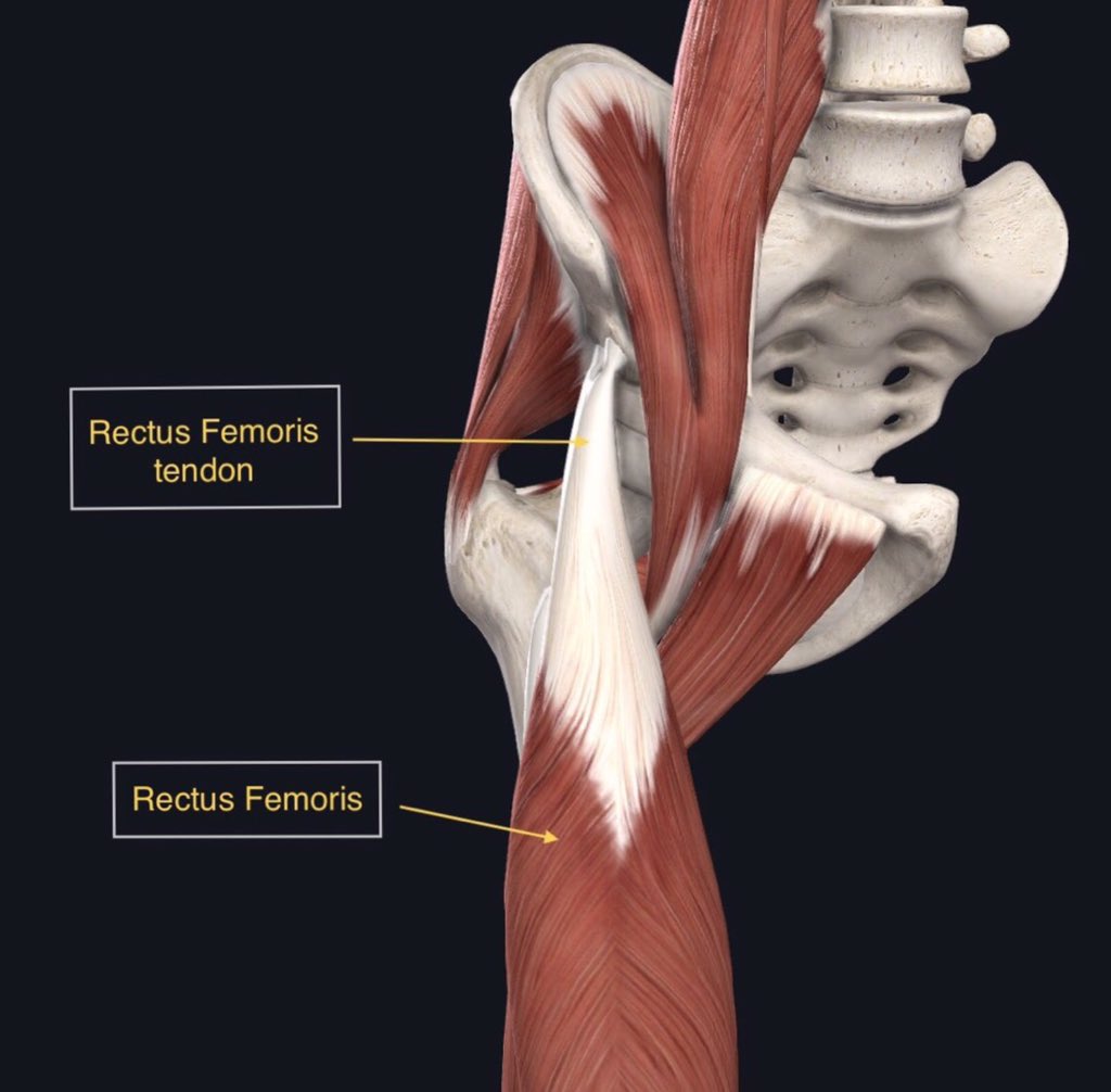 Rectus Femoris Tendon