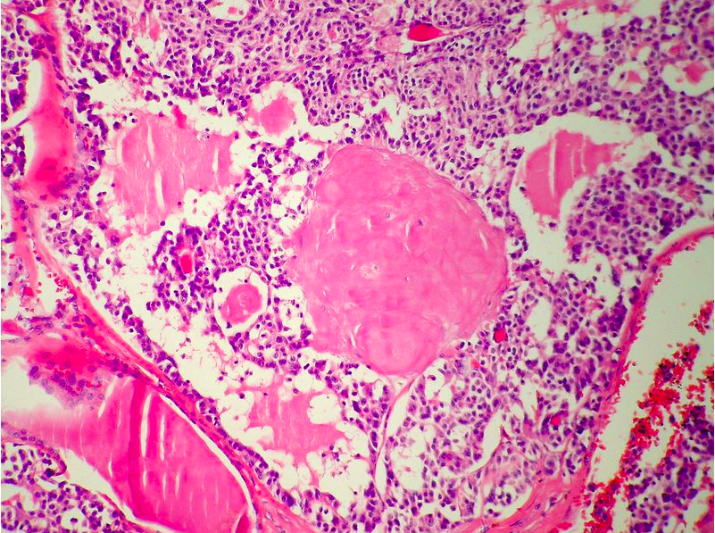 Nan Nwe Soe (@NanNweSoe) | Twitter