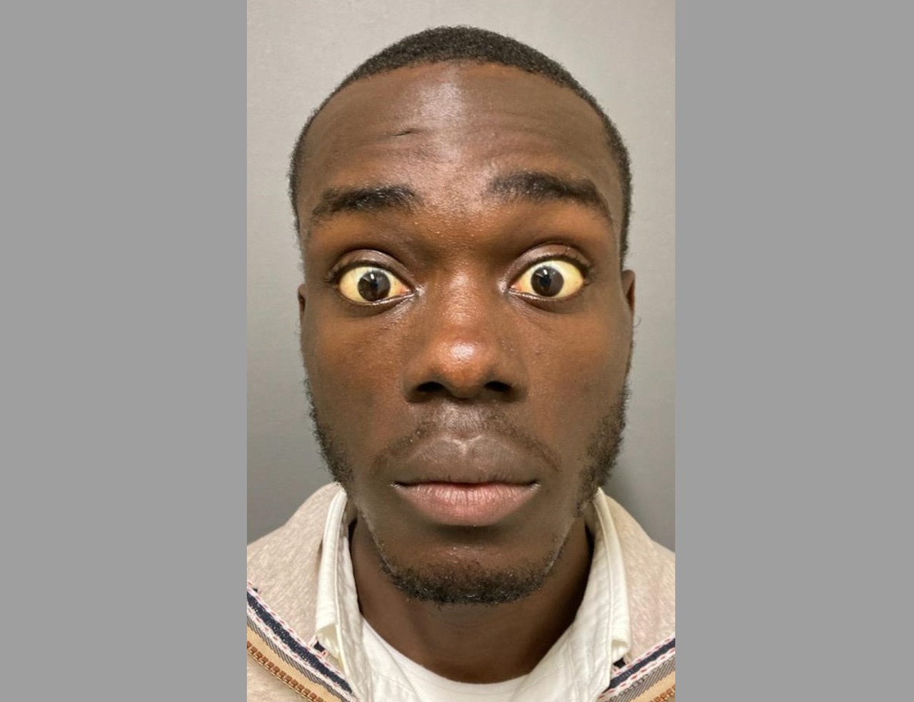 Black People With Yellow Eyes Hoe Gaat Het Met