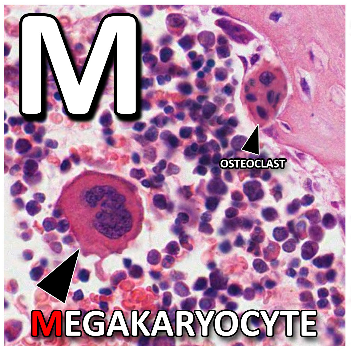Megakaryocyte Histology