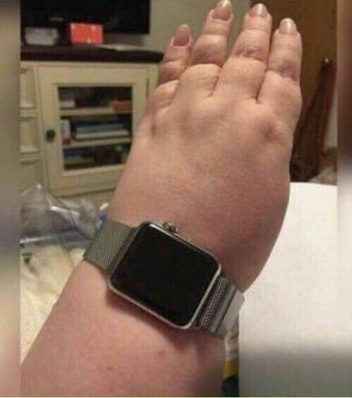 Pongamos fotos de manos feas - Forocoches