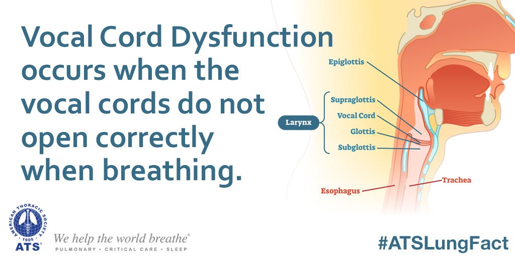 Vocal Cord Dysfunction