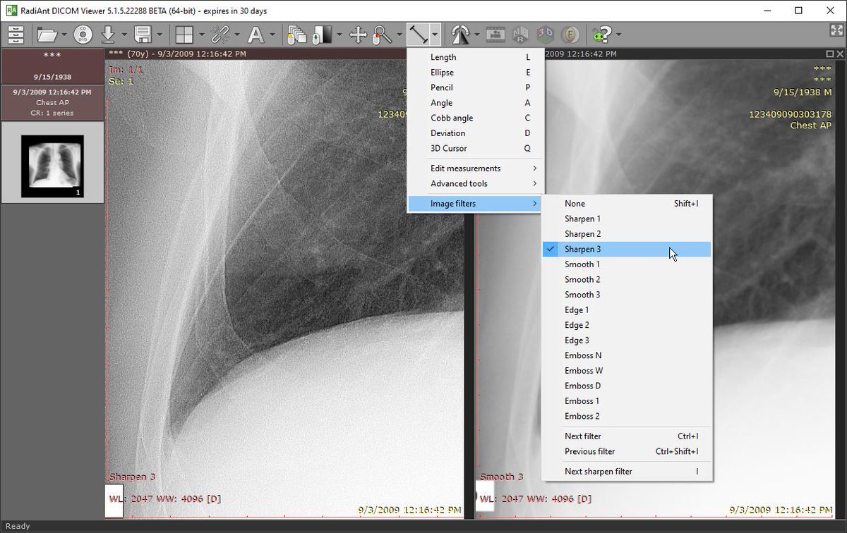 Radiant Dicom Viewer Multiple Windows