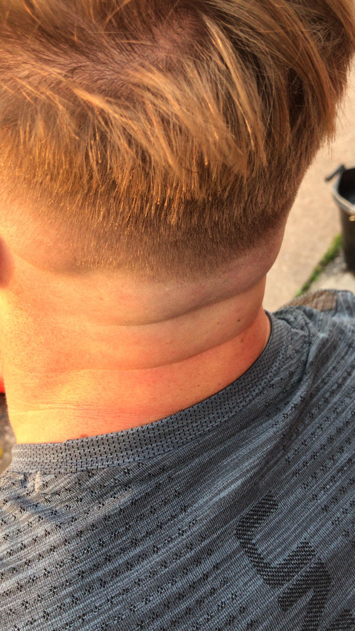 Cowlick Back Of Neck