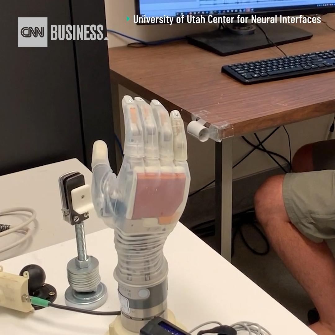 The LUKE Arm is a Star Wars-inspired prosthetic that sends signals to ...
