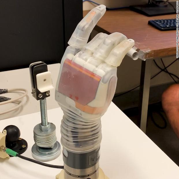 The Star Wars-inspired LUKE Arm sends signals to the brain in order to ...