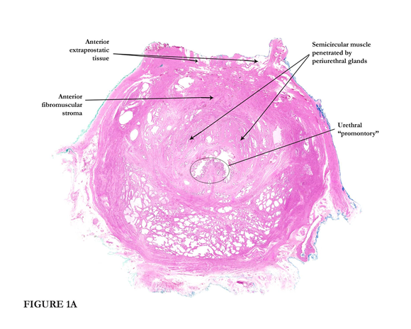 Prostate Anatomy Apex