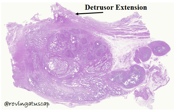 Detrusor Muscle Histology