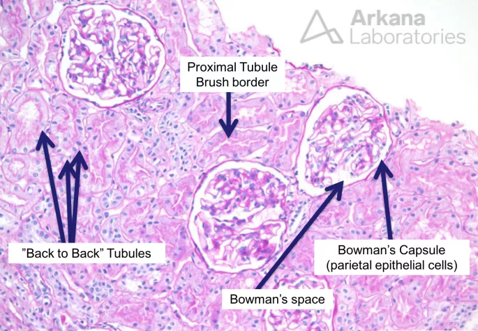 Bowmans Capsule Slide
