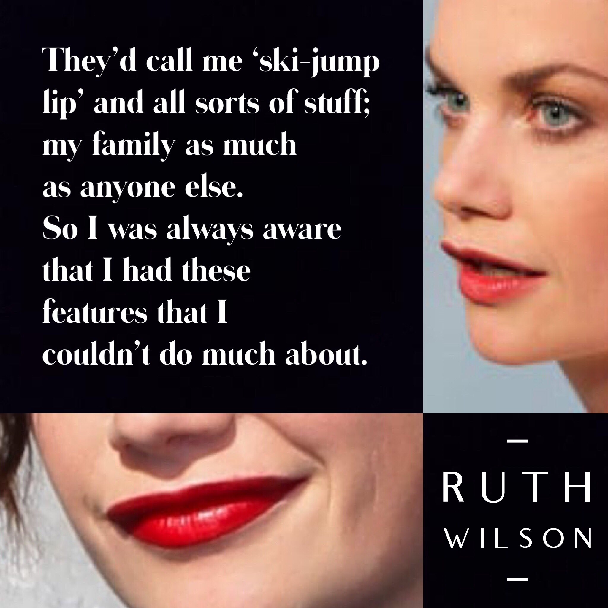 Ruth Wilson Lip Injecties