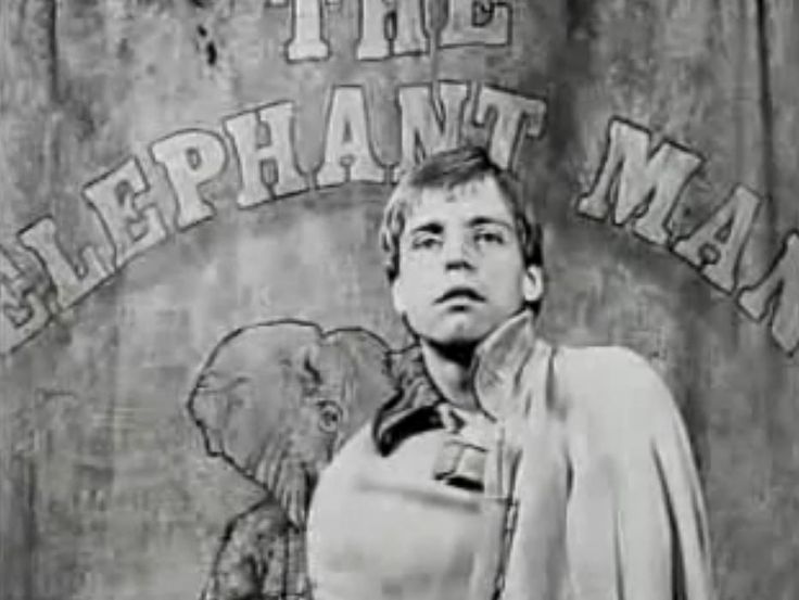 The Elephant Man Broadway Poster