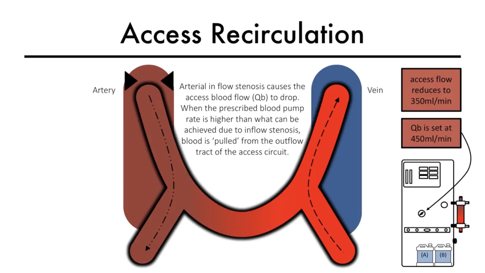 Hemodialysis Access