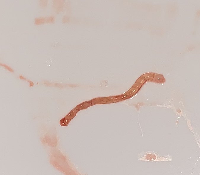 Kidney Biopsy Tissue Histopathology Of Kidney Biopsy Tissue . (a)