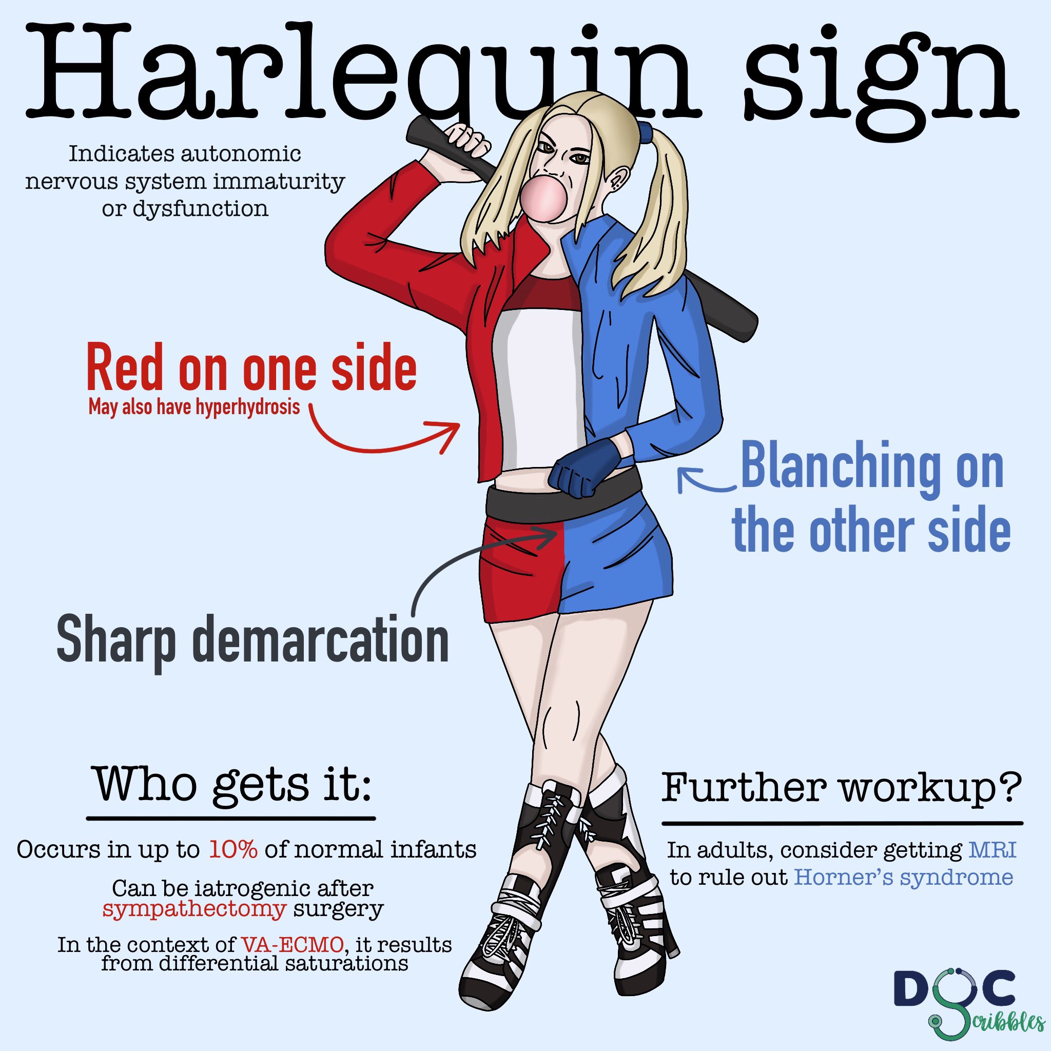 Harlequin Sign