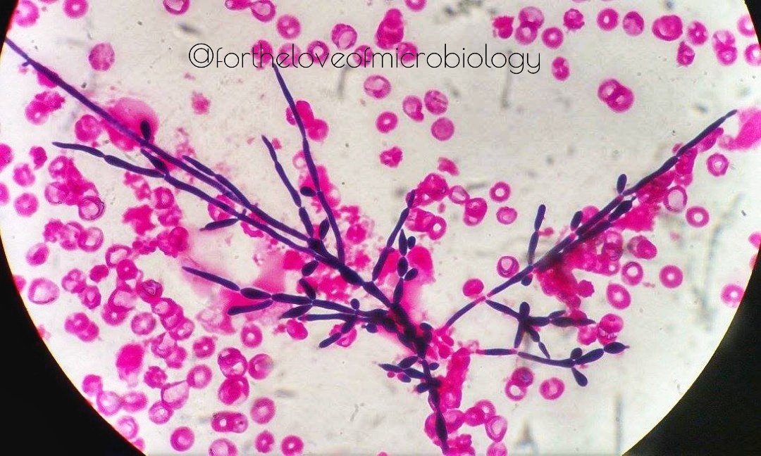 Budding Yeast Gram Stain